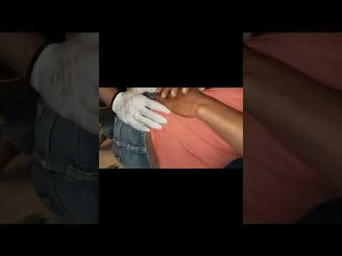 Punggung besar sebelah