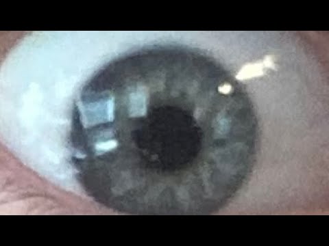 Eyeball - YouTube