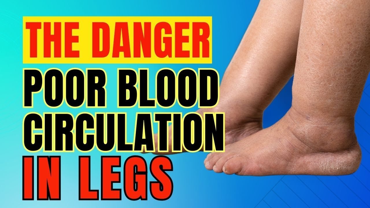 Don't Ignore These 14 warning signs of Poor Circulation in Legs-They ...