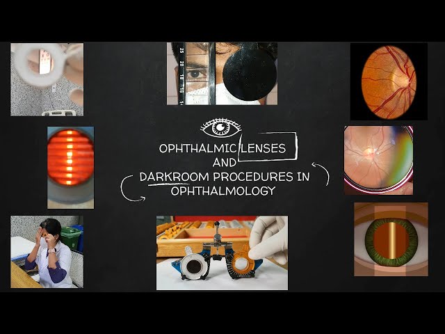 Opthalmic