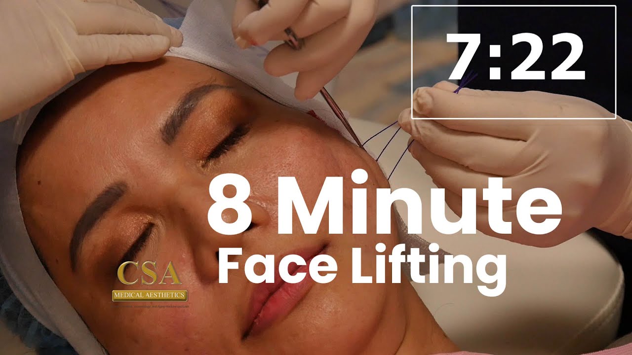8-Minute Face Lifting using COG threads - YouTube
