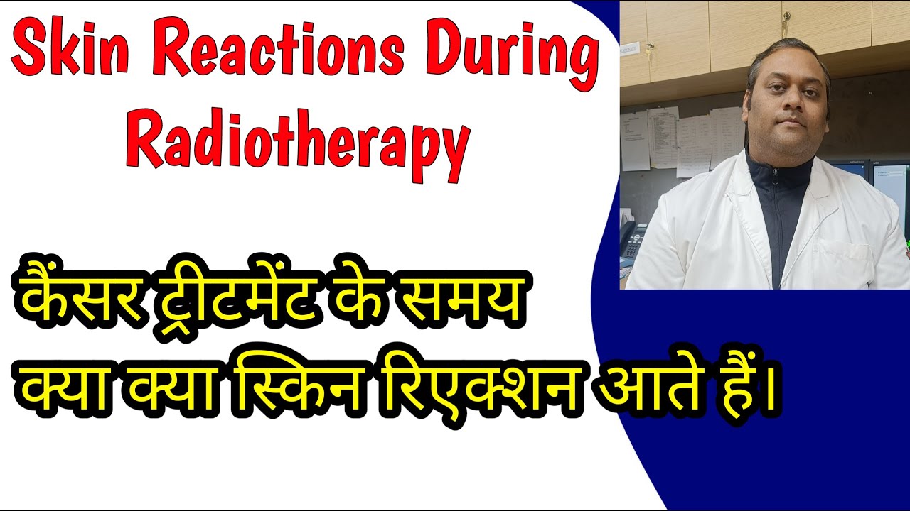 Skin Reactions During Radiotherapy Treatment #cancer - YouTube