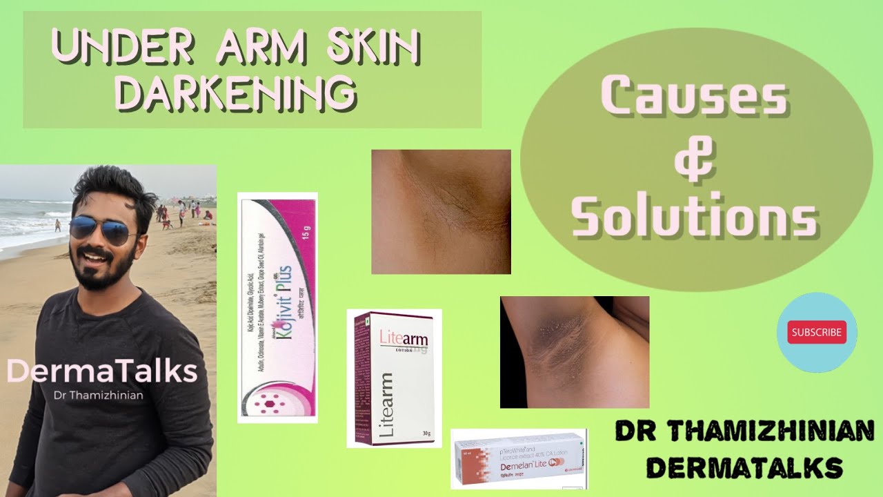 Underarm Skin darkening || Causes || Solutions || Dr Thamizhinian ...