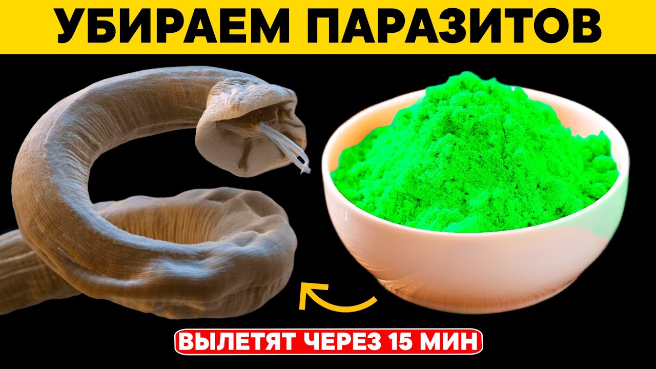 Моментальное выведение ГЛИСТОВ и других ПАРАЗИТОВ. Вылетят через 15 ...