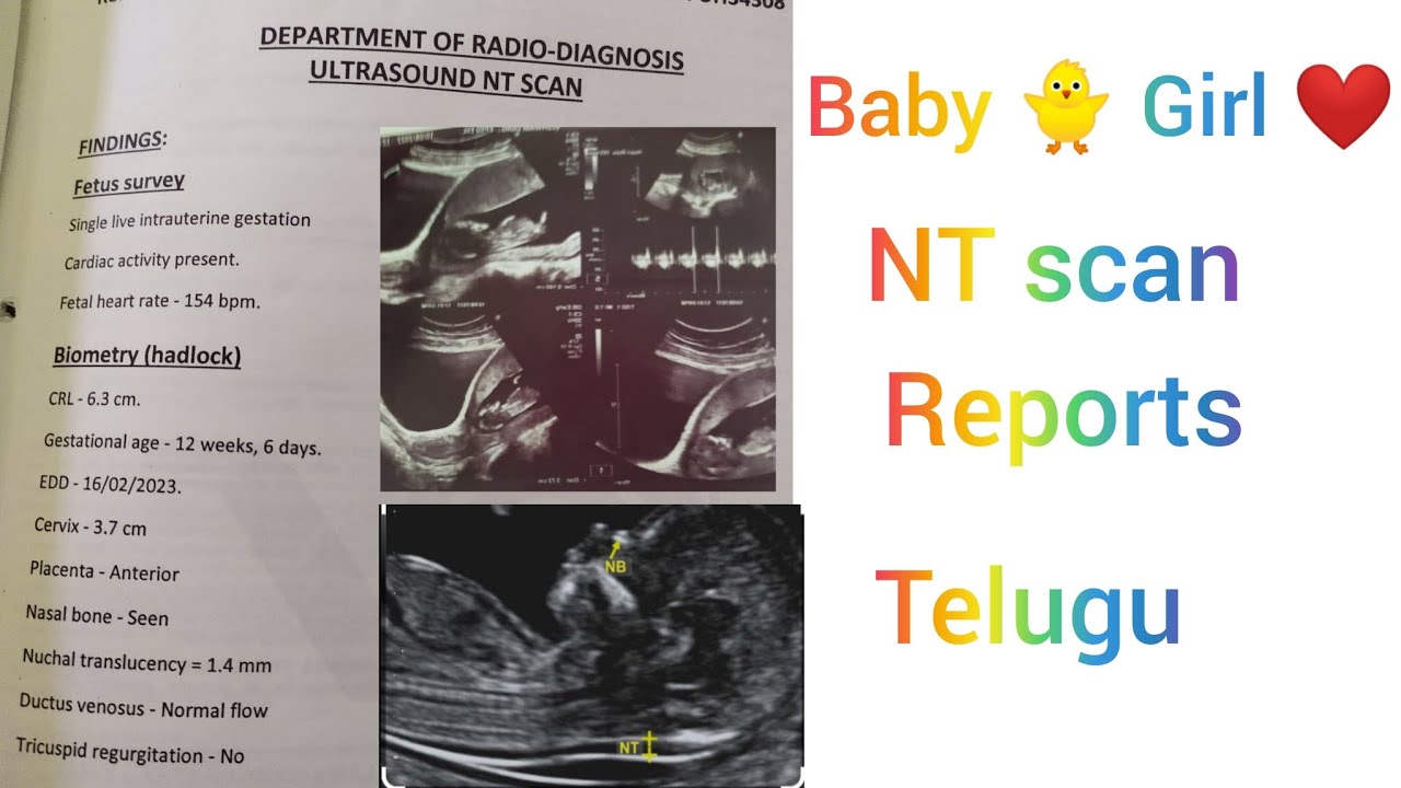 Baby Girl NT scan reports explained in telugu#ntscan #telugu # ...