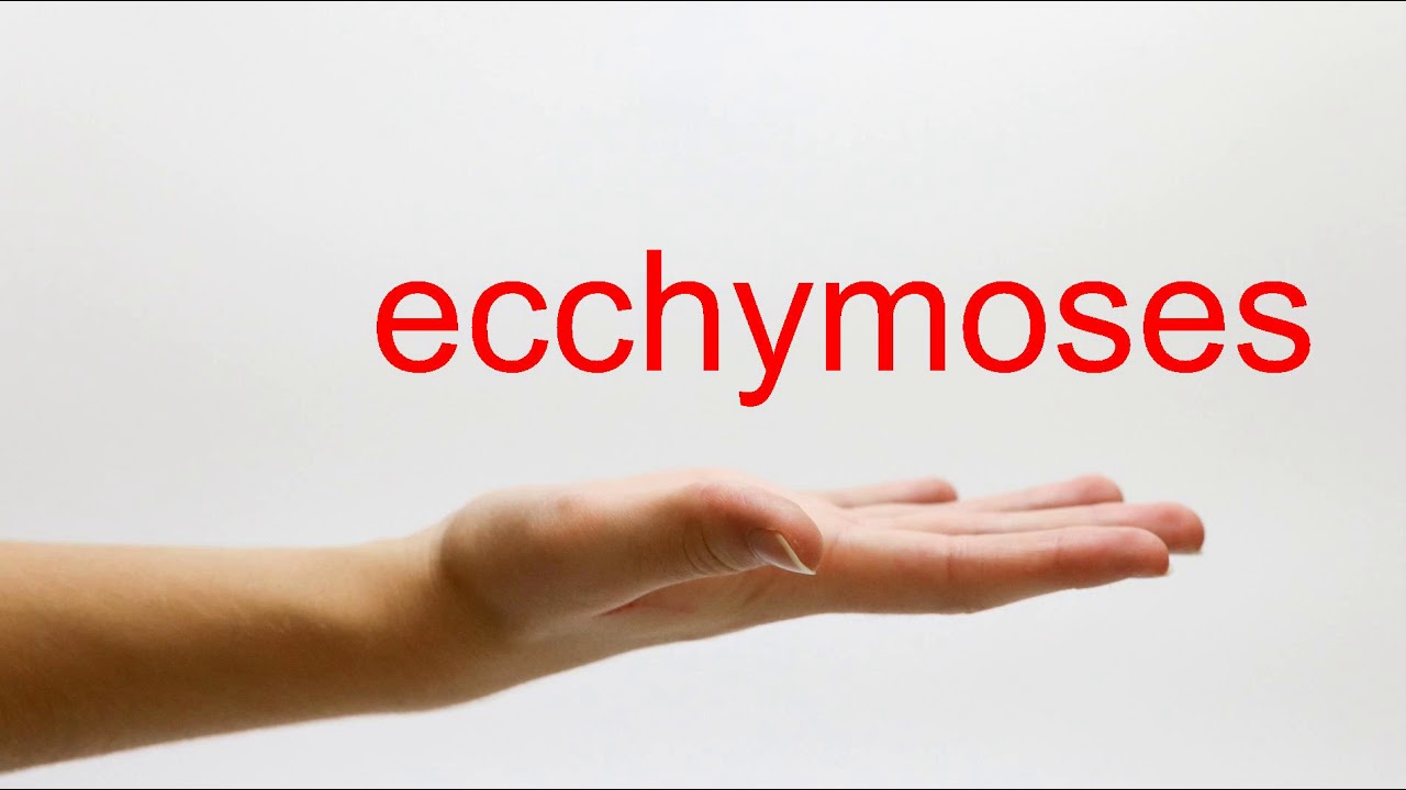 How to Pronounce ecchymoses - American English - YouTube