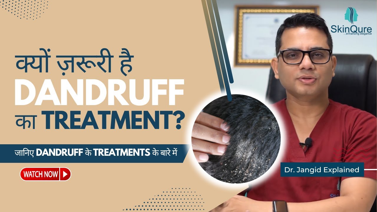 Why is it necessary to treat dandruff? | Dandruff Treatment in Delhi ...