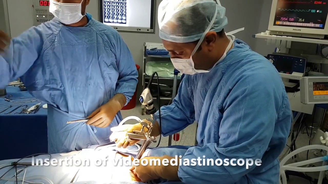 Mediastinoscopy - YouTube