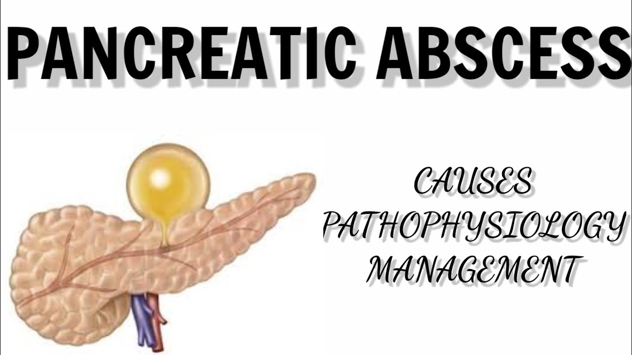 Pancreatic abscess in Urdu/hindi - Alternation in hepatobilary system ...