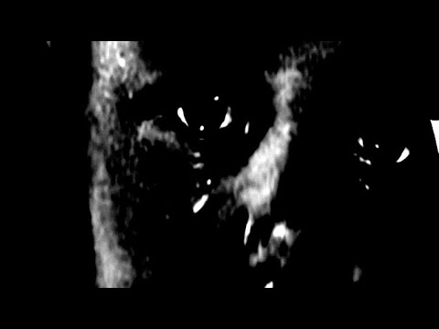 curse of the crying boy painting [analog horror] - YouTube