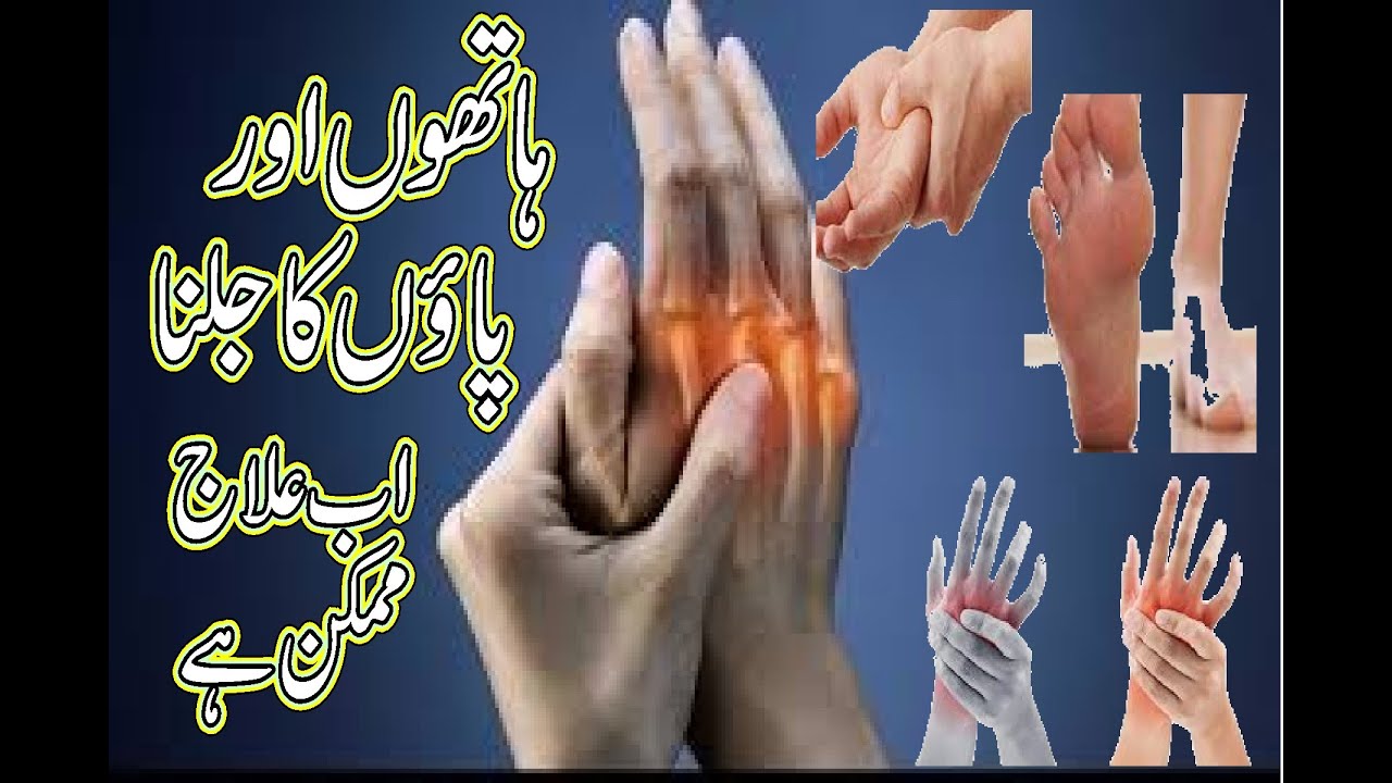 Haatho or Paon ka jalna or es ka elaj - YouTube