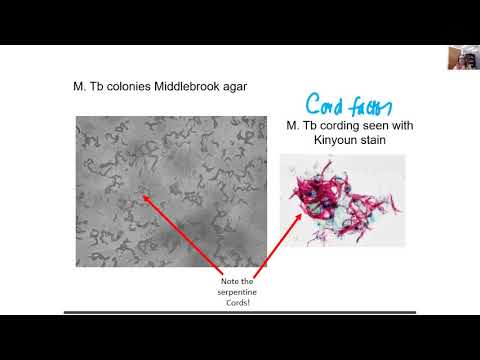 Mtb Dx and Rx - YouTube