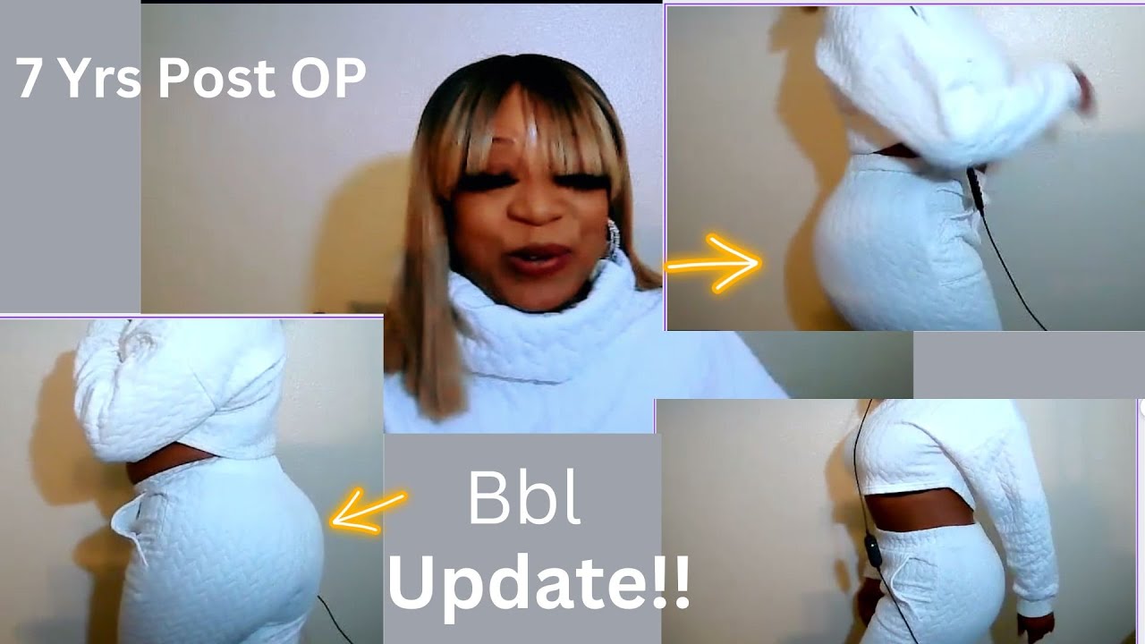 "My Journey to a 7 Year Post Bbl : A Personal Update" - YouTube