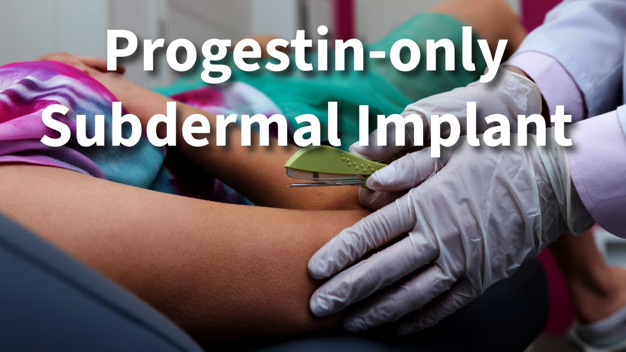 Subdermal Implant - YouTube