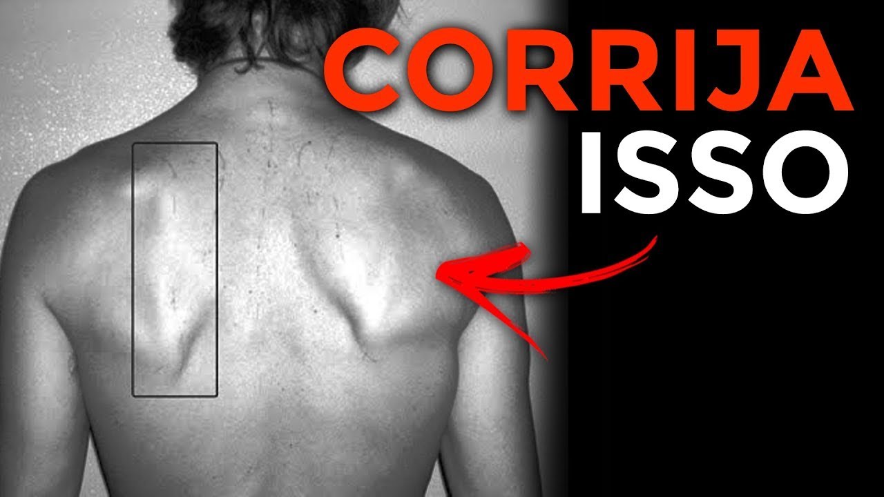 Como CORRIGIR as ESCÁPULAS ALADAS 5 Exercícios DEFINITIVAMENTE Em Casa ...