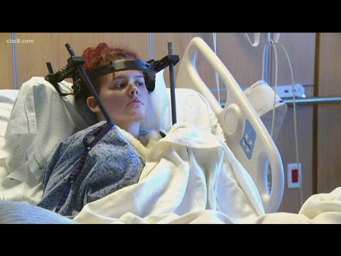 Doctors save teen with internal decapitation