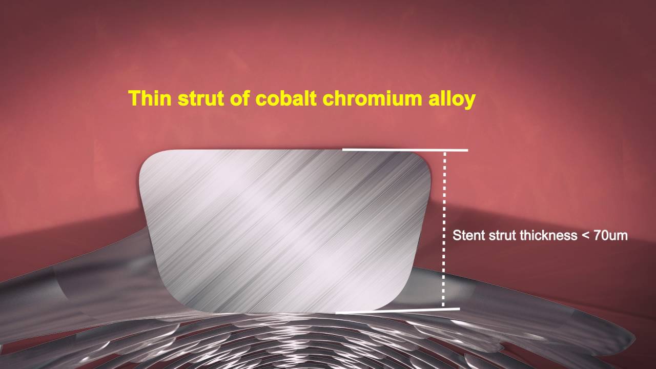 Genoss DES Introduction Video - YouTube