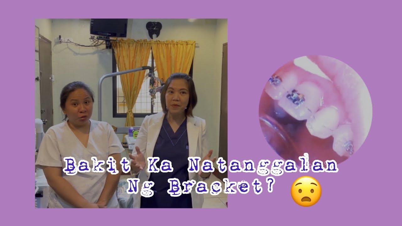 BAKIT KA NATANGGALAN NG BRACKET? - YouTube