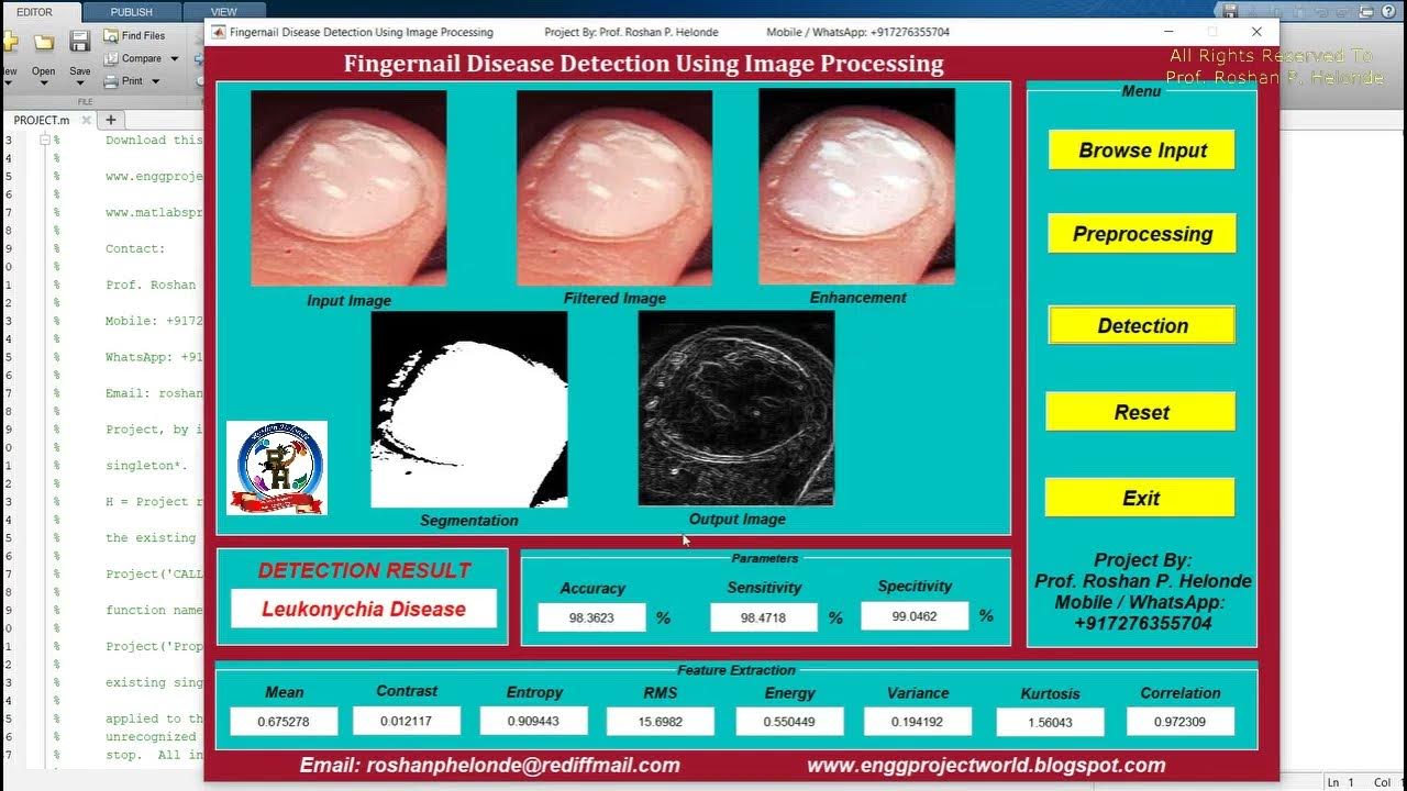 Fingernail Disease Detection Using Image Processing Source Code Fingernail Disease Detect ...