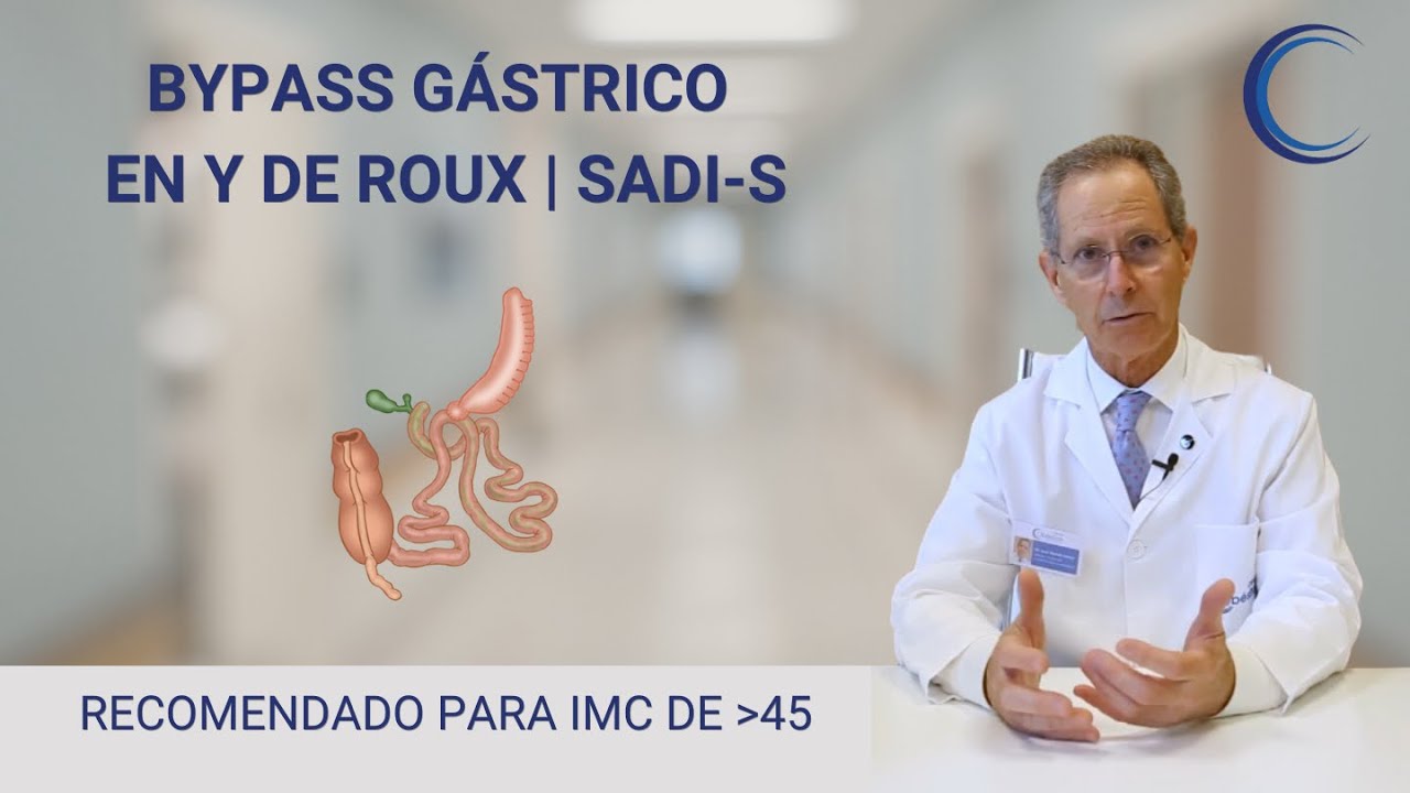 Webinar- Bypass Gástrico y Tipo SADI-S - YouTube
