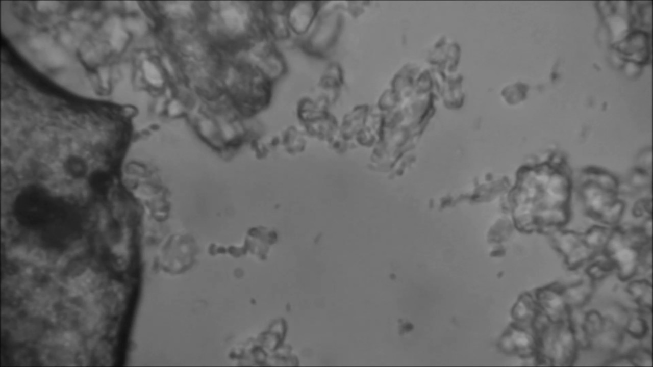 Apparently normal sample inner cheese under Zeiss IM microscope bright ...