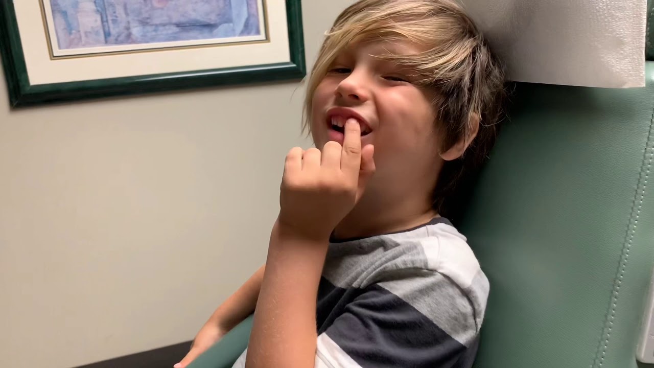 Adult Teeth Pushing Out Baby Teeth - YouTube
