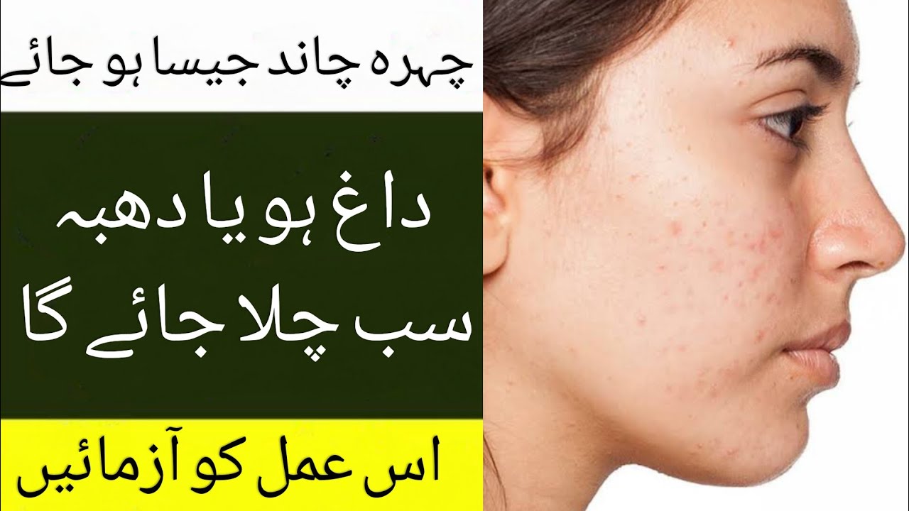 Chehre Or Jism K Daag Dhabbay Hatany Ka Wazifa/Wazifa for Beautiful ...