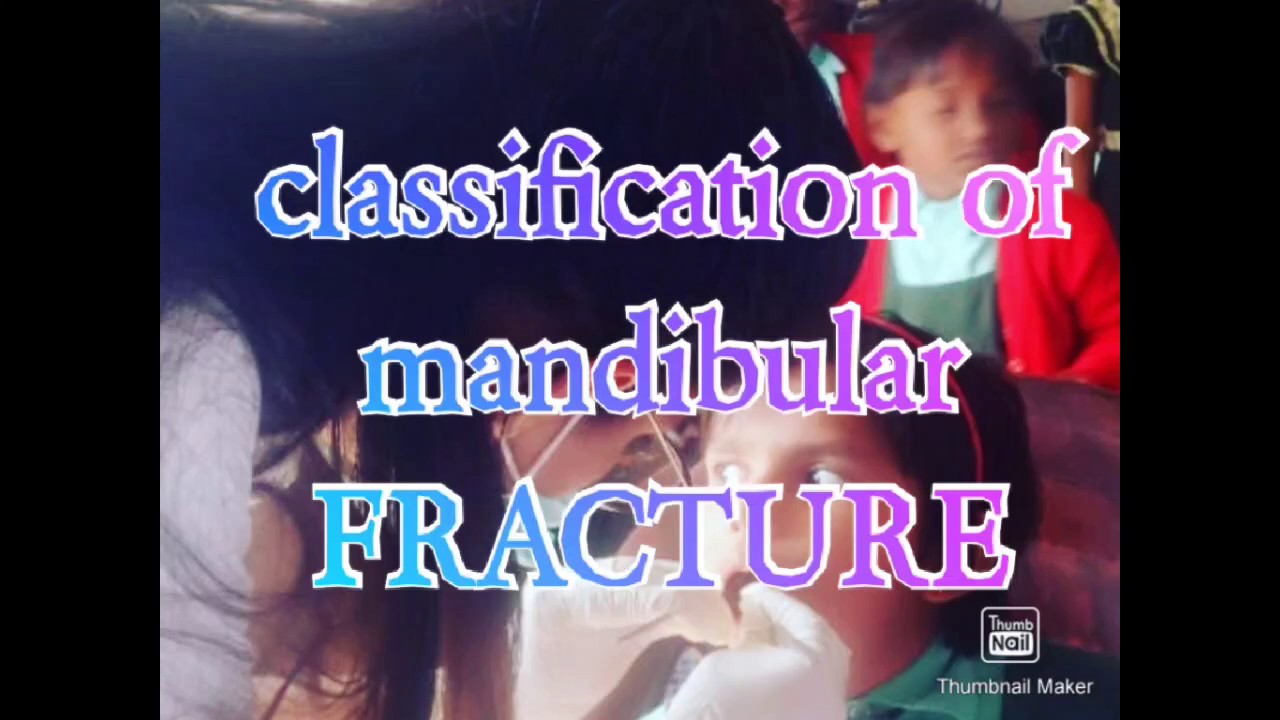 Classification of mandibular FRACTURE part 1 - YouTube