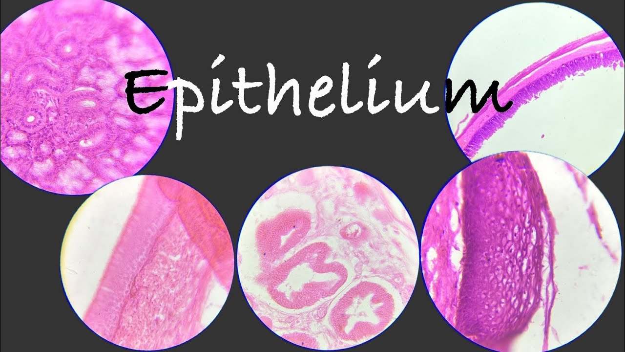 Epithelial tissue explained with histology slides for examination - YouTube