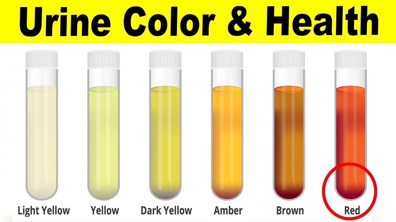 What Does The Color Of Your Urine Say About Your Health? - YouTube