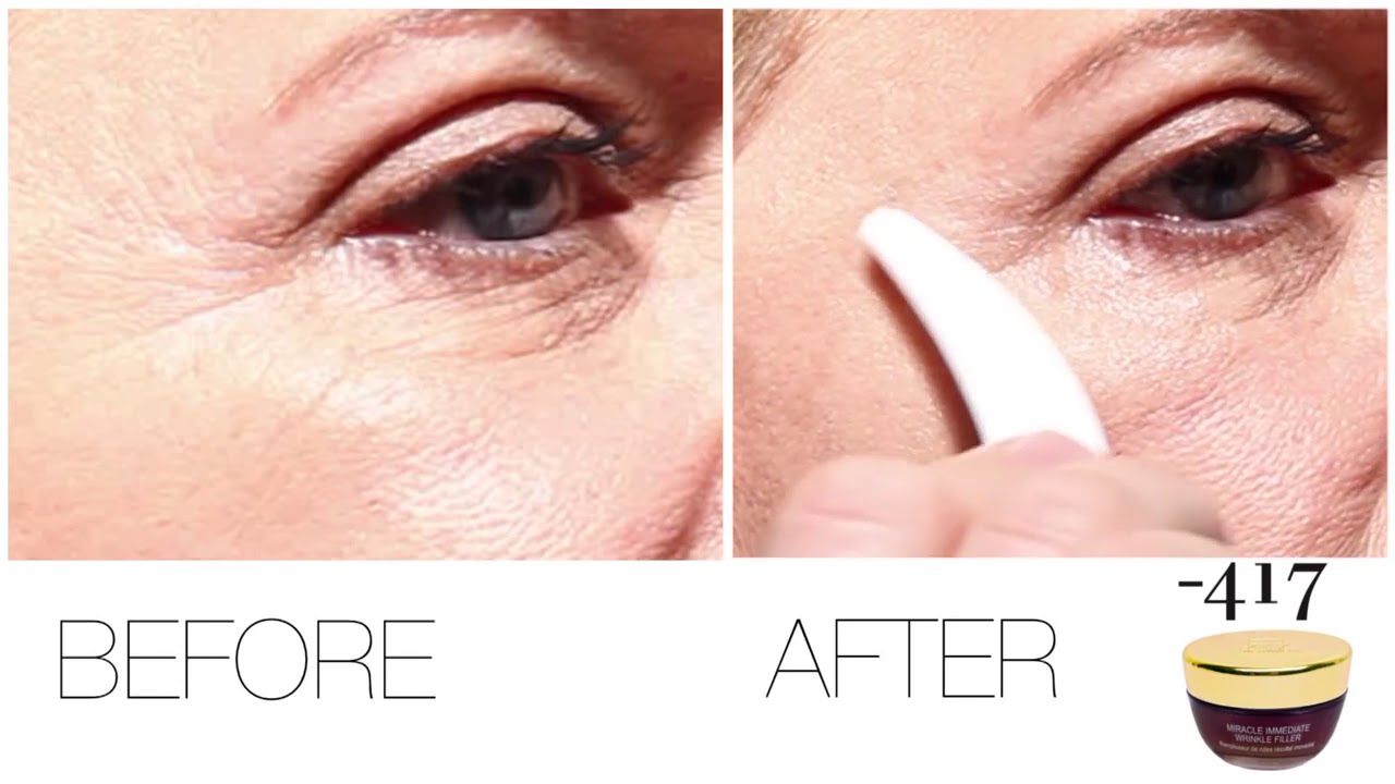 Minus 417 - Miracle immediate wrinkle filler - YouTube