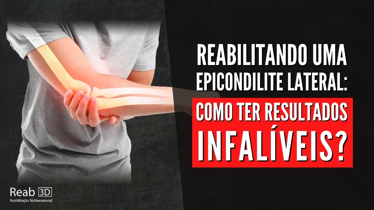 REABILITANDO UMA EPICONDILITE LATERAL: COMO TER RESULTADOS INFALÍVEIS ...