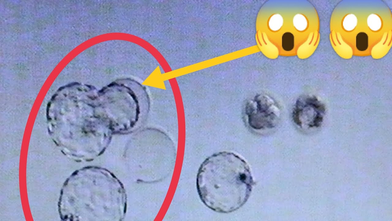 What is a hatching blastocyst? ,hatching blastocyst success rates # ...