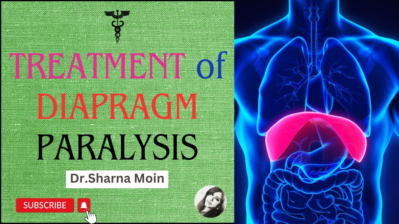 Breathing Easy! Navigating Diaphragm Paralysis with Expert Solutions ...