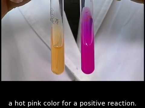 Urease and gelatinase test - YouTube