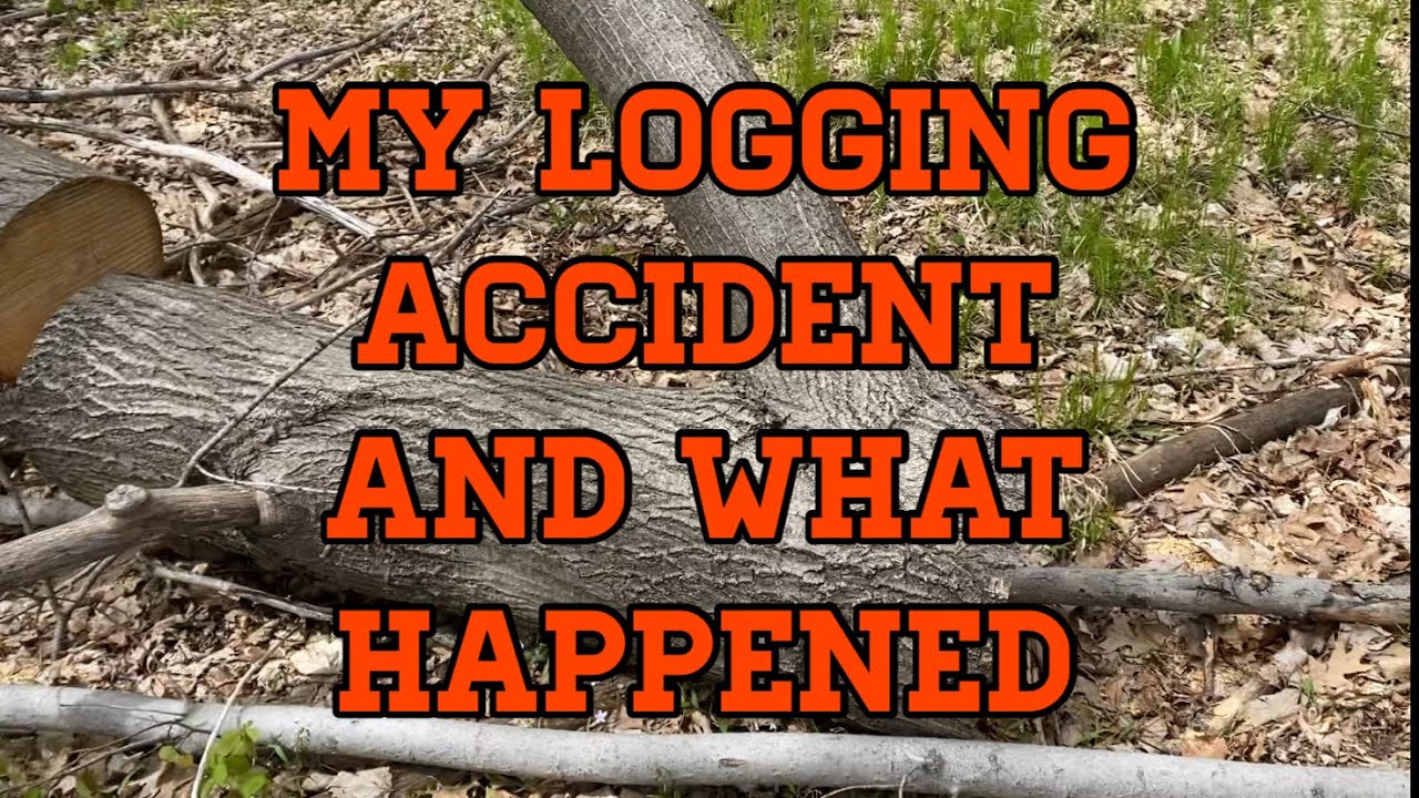 My logging accident and what happened - YouTube