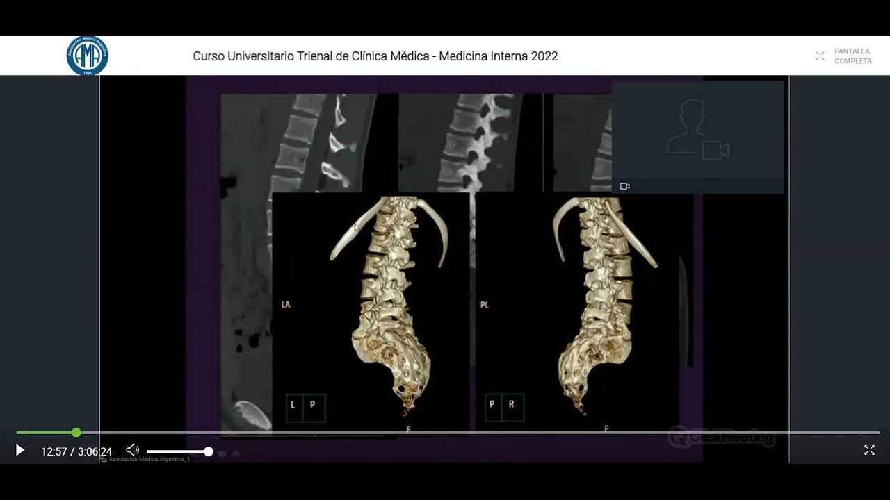 MODULO DE FARMACOLOGIA / VALORACION POR IMAGENES DEL DOLOR LUMBOSACRO ...