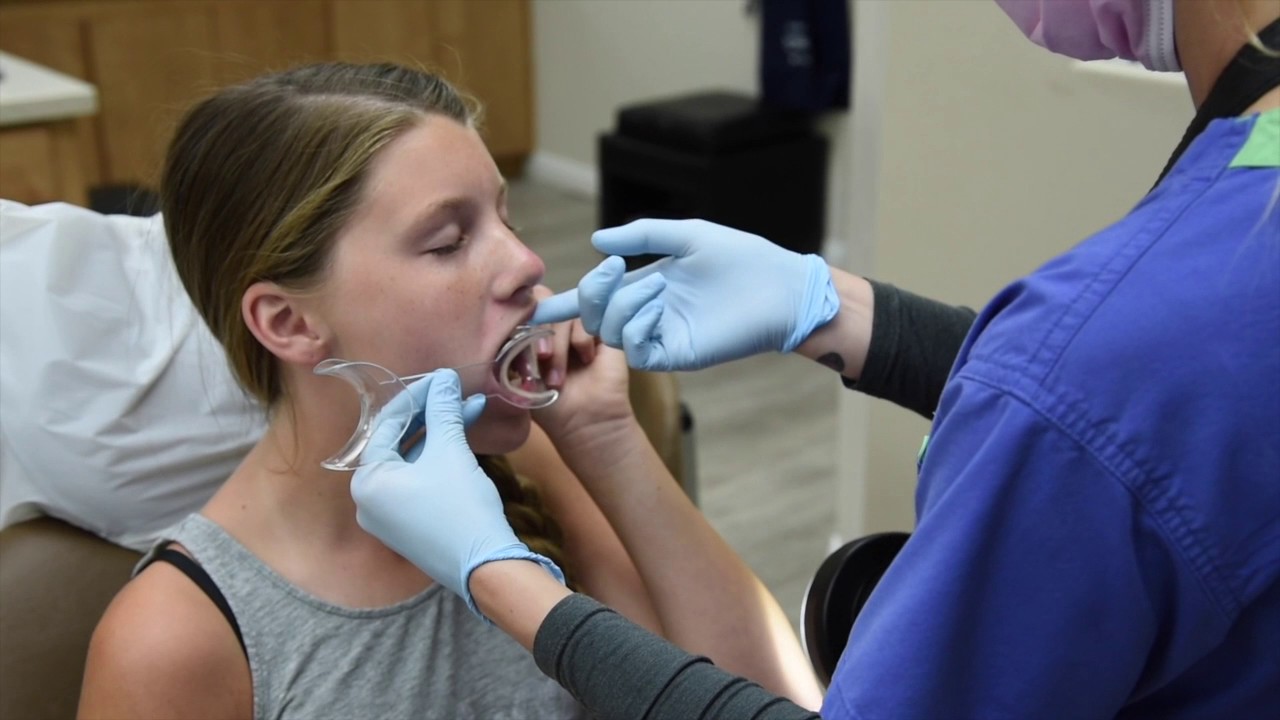 Invisalign Teen First Appointment #ad - YouTube