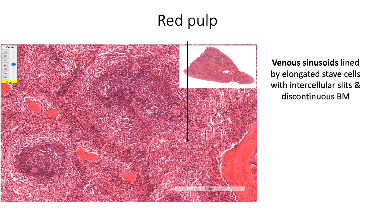 Histology with Chimmalgi: Spleen - YouTube