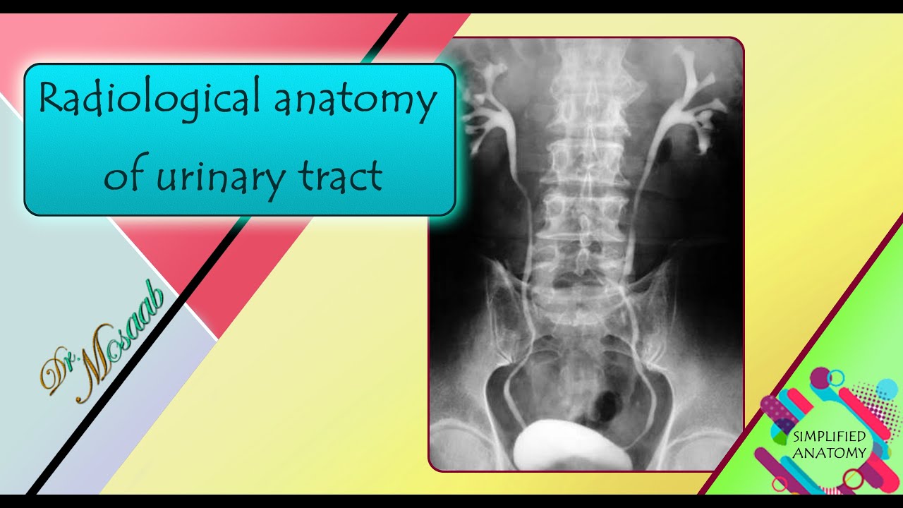 Radiological anatomy of urinary tract (Plain X-ray & intravenous ...