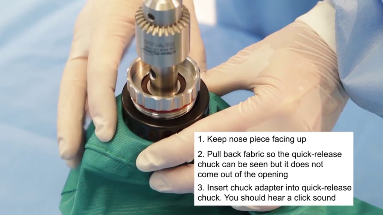 Securos Surgical - Arbutus Loading Instructions - YouTube