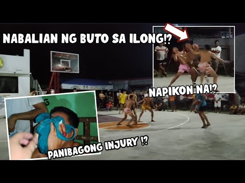 NABALIAN NG BUTO SA ILONG!? PANIBAGONG INJURY ULIT !? - vlog.2 - YouTube