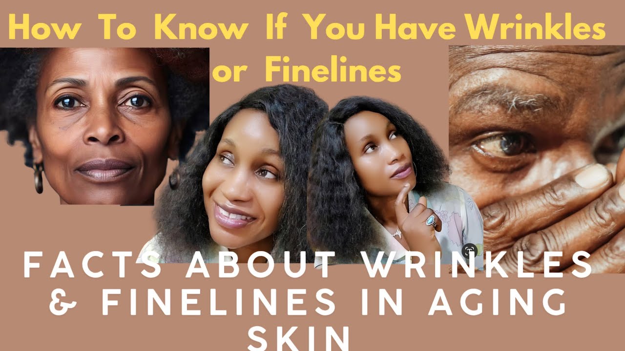 FACTS ABOUT: Wrinkles and Fine Lines In Aging Skin/ How To Know If You ...