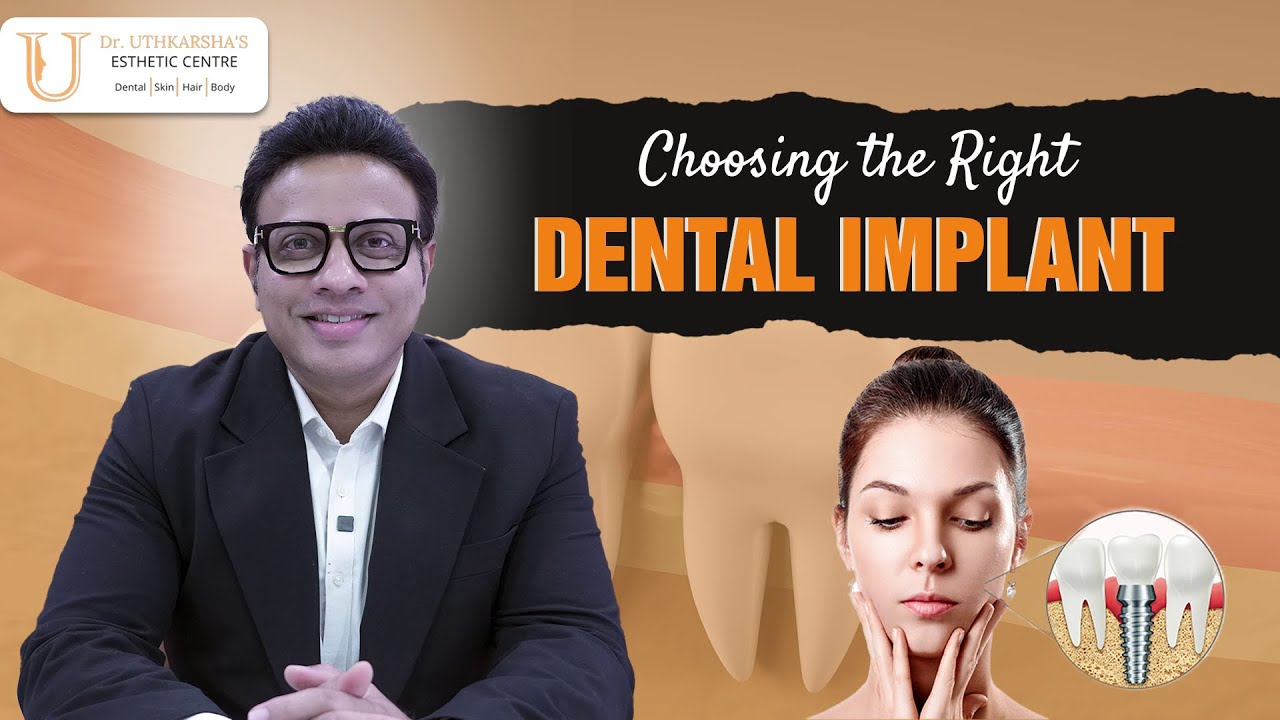 How to Choose the Right Dental Implant | Expert Guide - Dr. Utkarsha ...