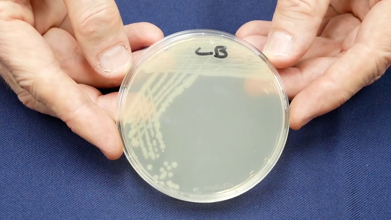 pGreen Bacterial Transformation - YouTube