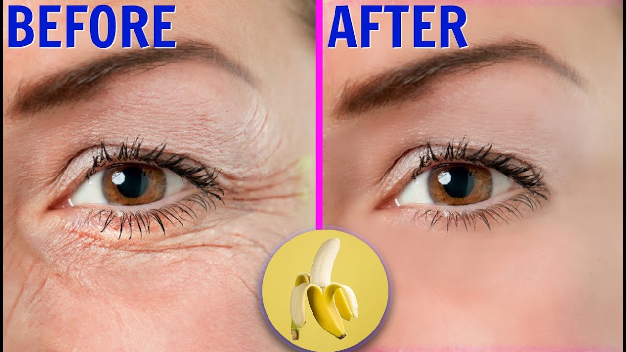 How to get rid of wrinkles naturally/ Skin Care Tips / Remove Wrinkles ...