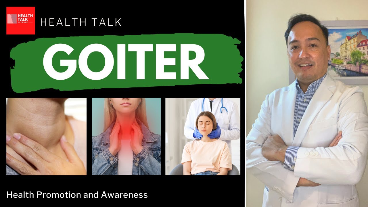 Goiter: Symptoms, Causes, Types, Diagnosis and Treatment - YouTube