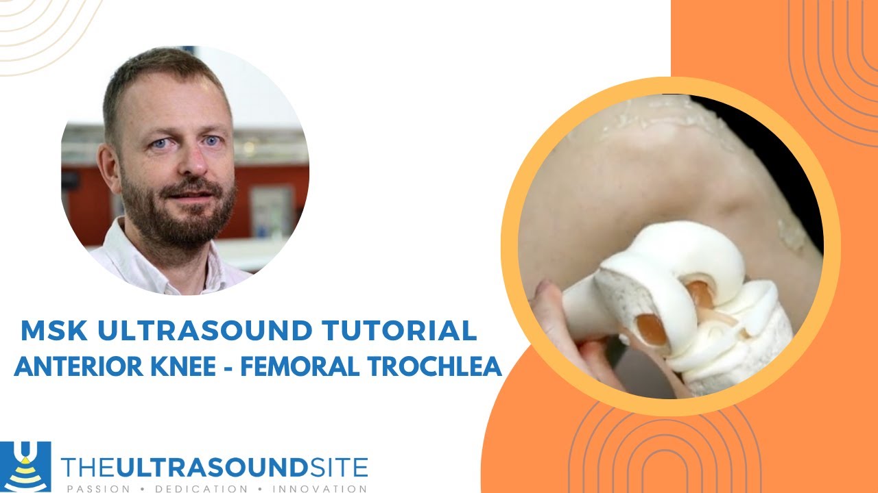 MSK ultrasound of the femoral trochlea of the knee - YouTube