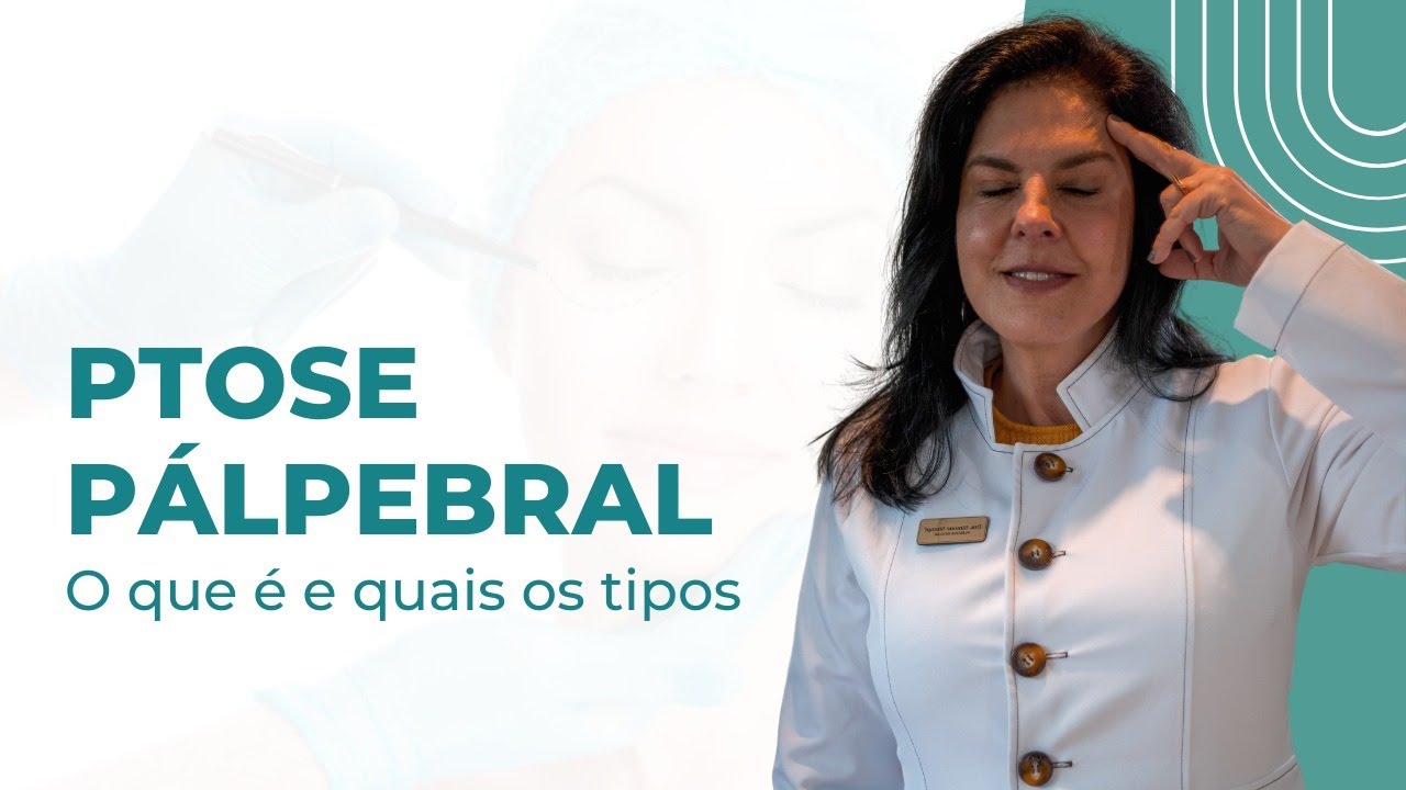 PTOSE PALPEBRAL - O QUE É E QUAIS OS SEUS TIPOS - YouTube