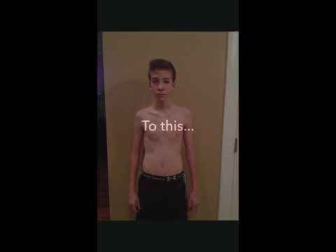 SKINNY 16 Year Old *Crazy Transformation*